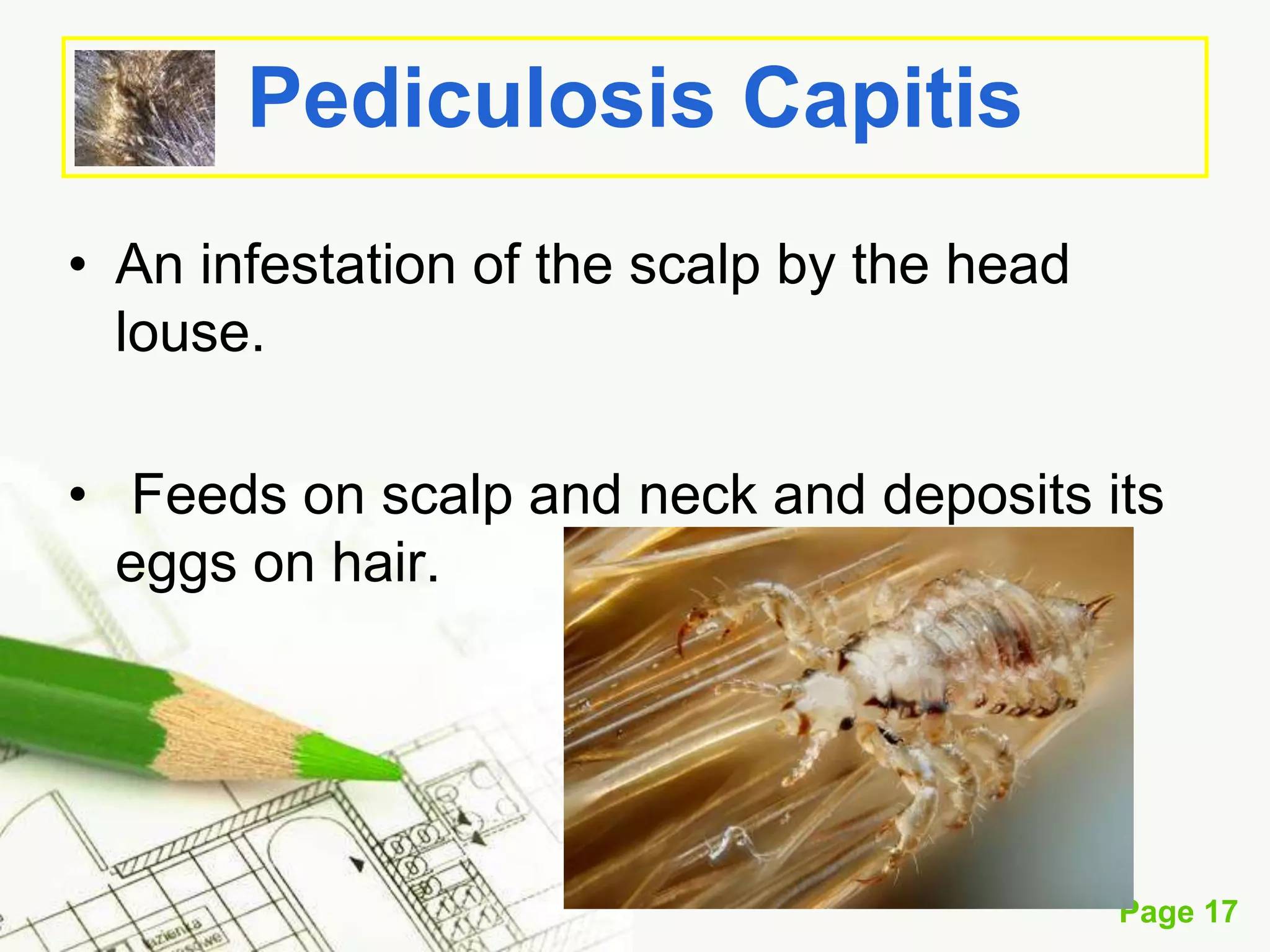 Pediculosis | PPT