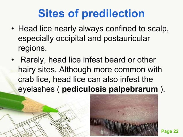 Pediculosis | PPT | Infectious Diseases | Diseases and Conditions