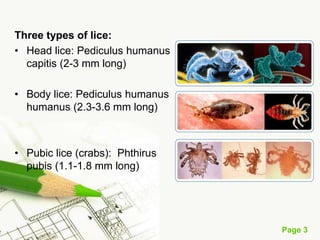 Pediculosis Corpus