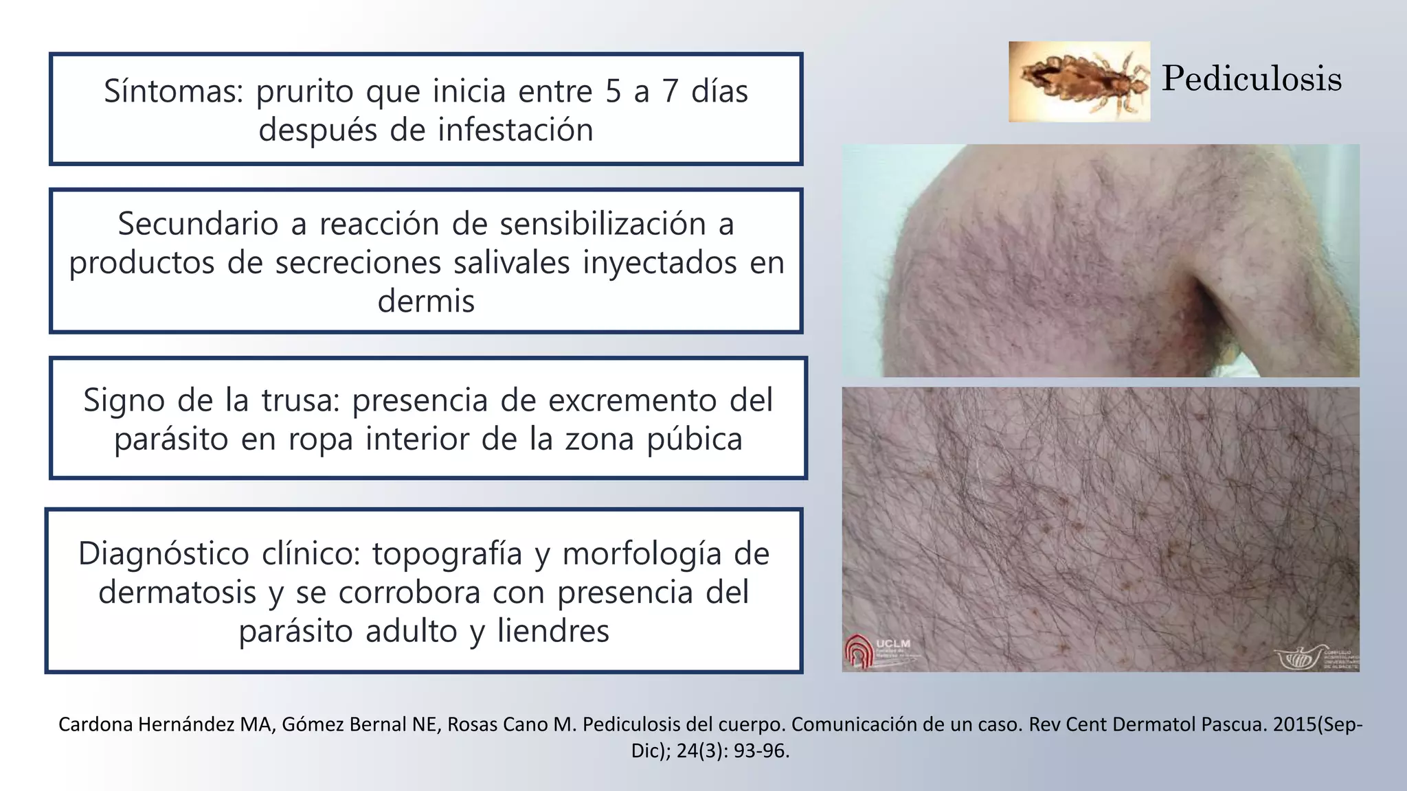 Pediculosis | PPTX