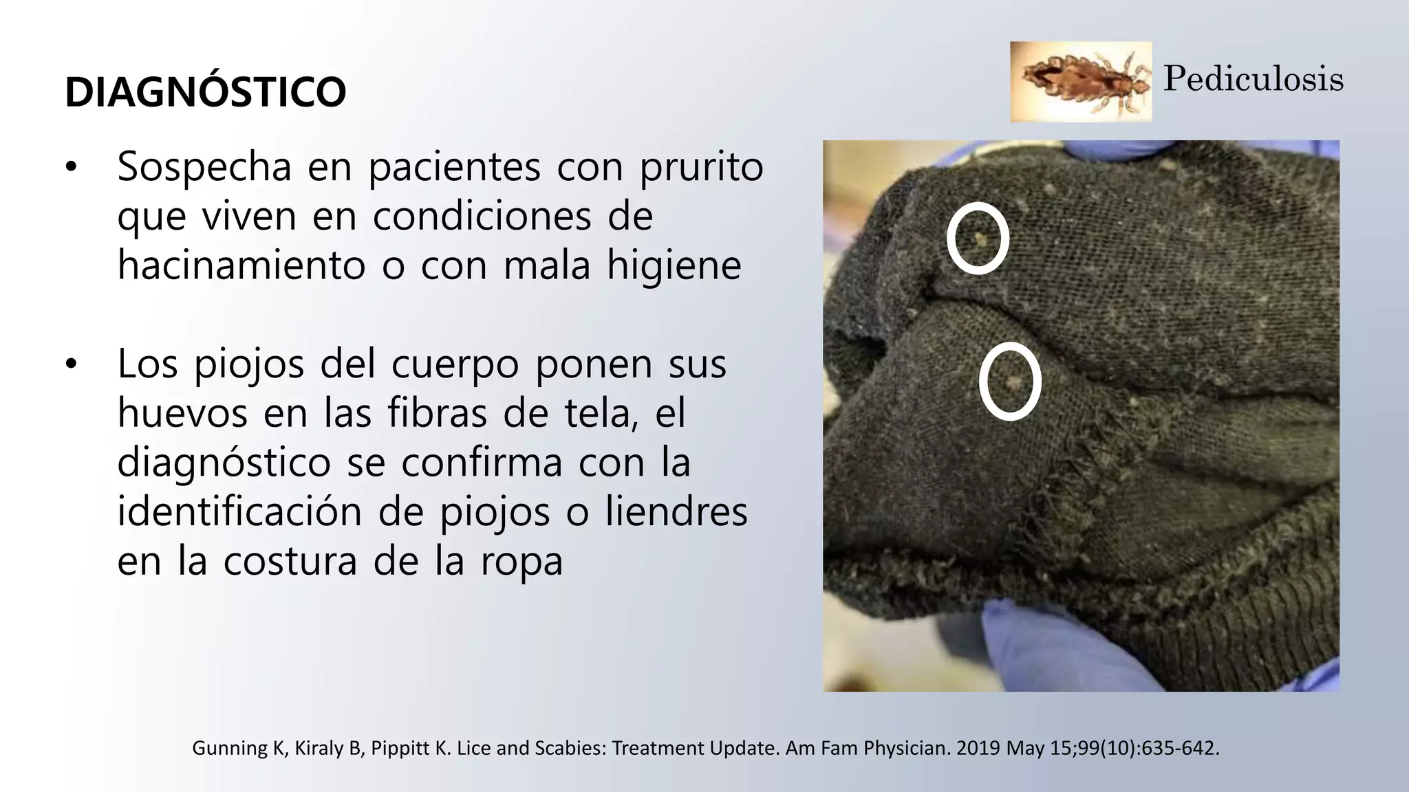 Pediculosis | PPTX