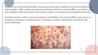 Pediculosis.pptx........................ | PPTX