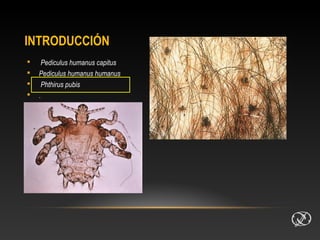 Pediculosis Pubica
