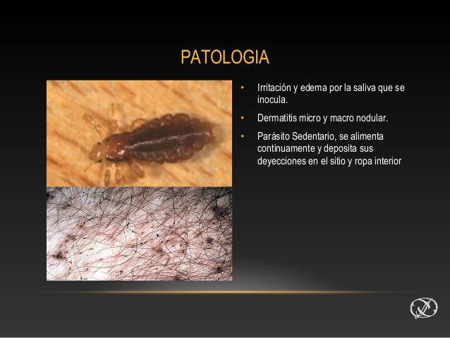 Pediculosis púbica (Phthirus pubis-Ladillas)