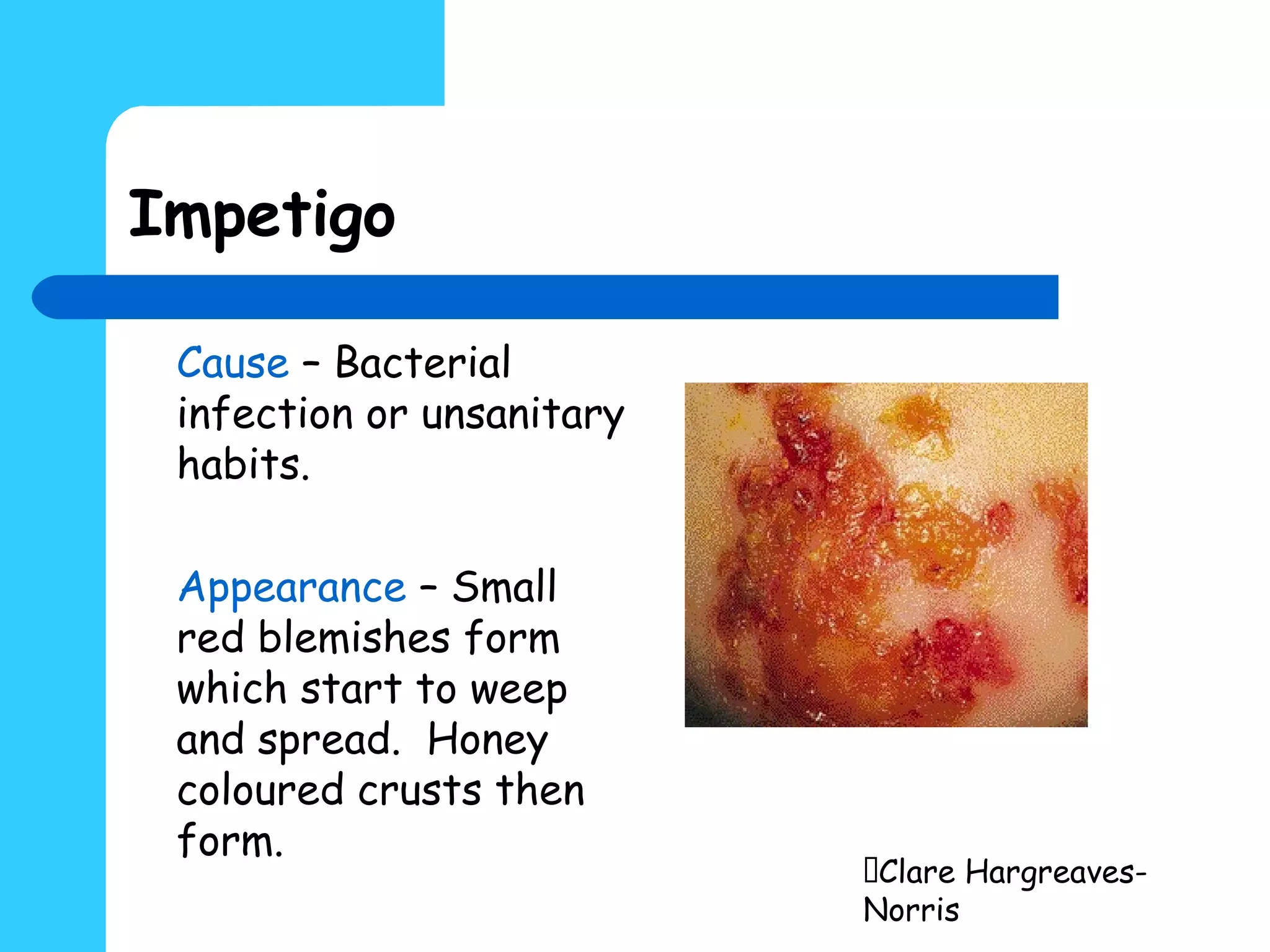 Pedicure contra-indications | PPT