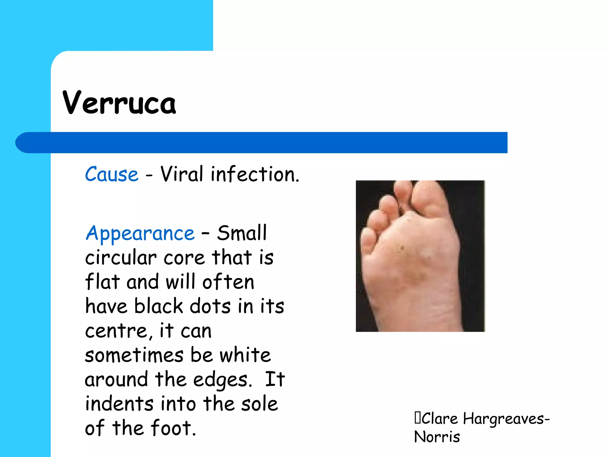 Pedicure contra-indications | PPT