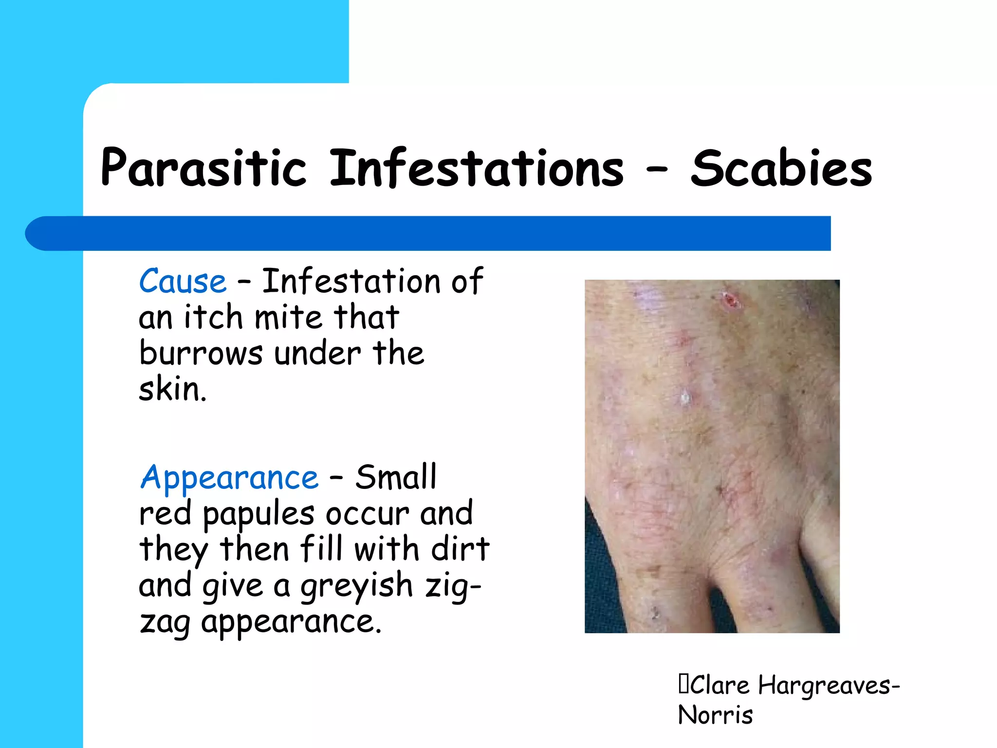 Pedicure contra-indications | PPT