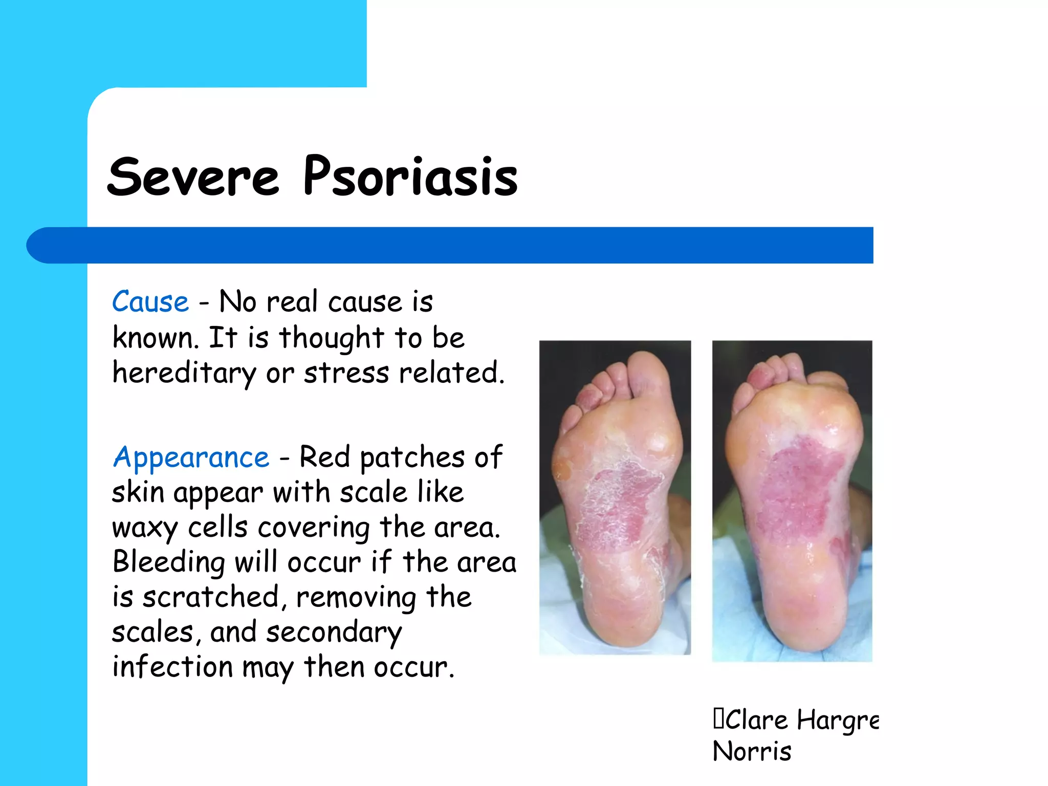 Pedicure contra-indications | PPT