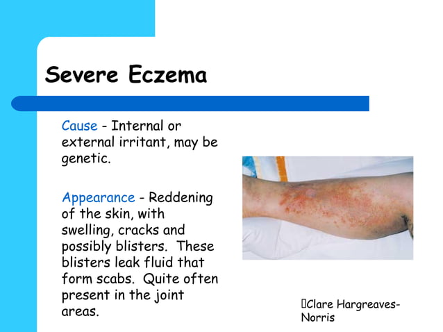 Pedicure contra-indications | PPT