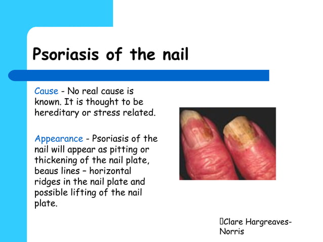 Pedicure contra-indications | PPT