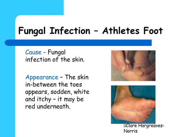 Pedicure contra-indications | PPT