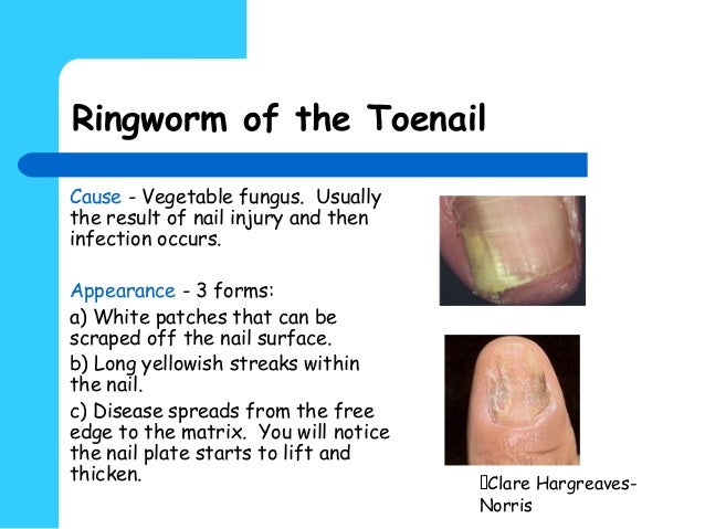 Pedicure contra-indications