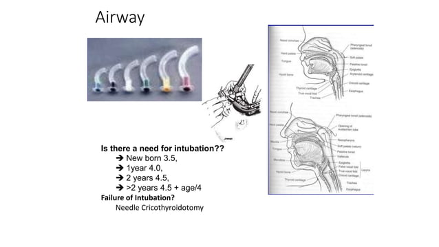 pediatric trauma early diagnosis, evaluation and management | PPTX