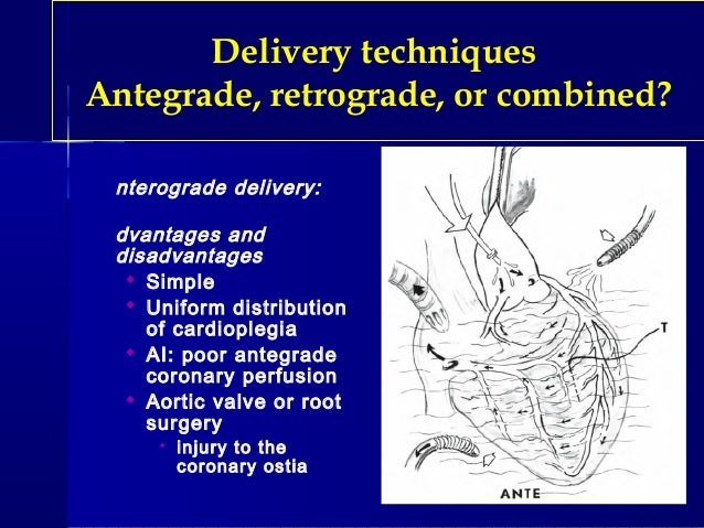 Myocardial Protection in Pediatric Cardiac Surgery