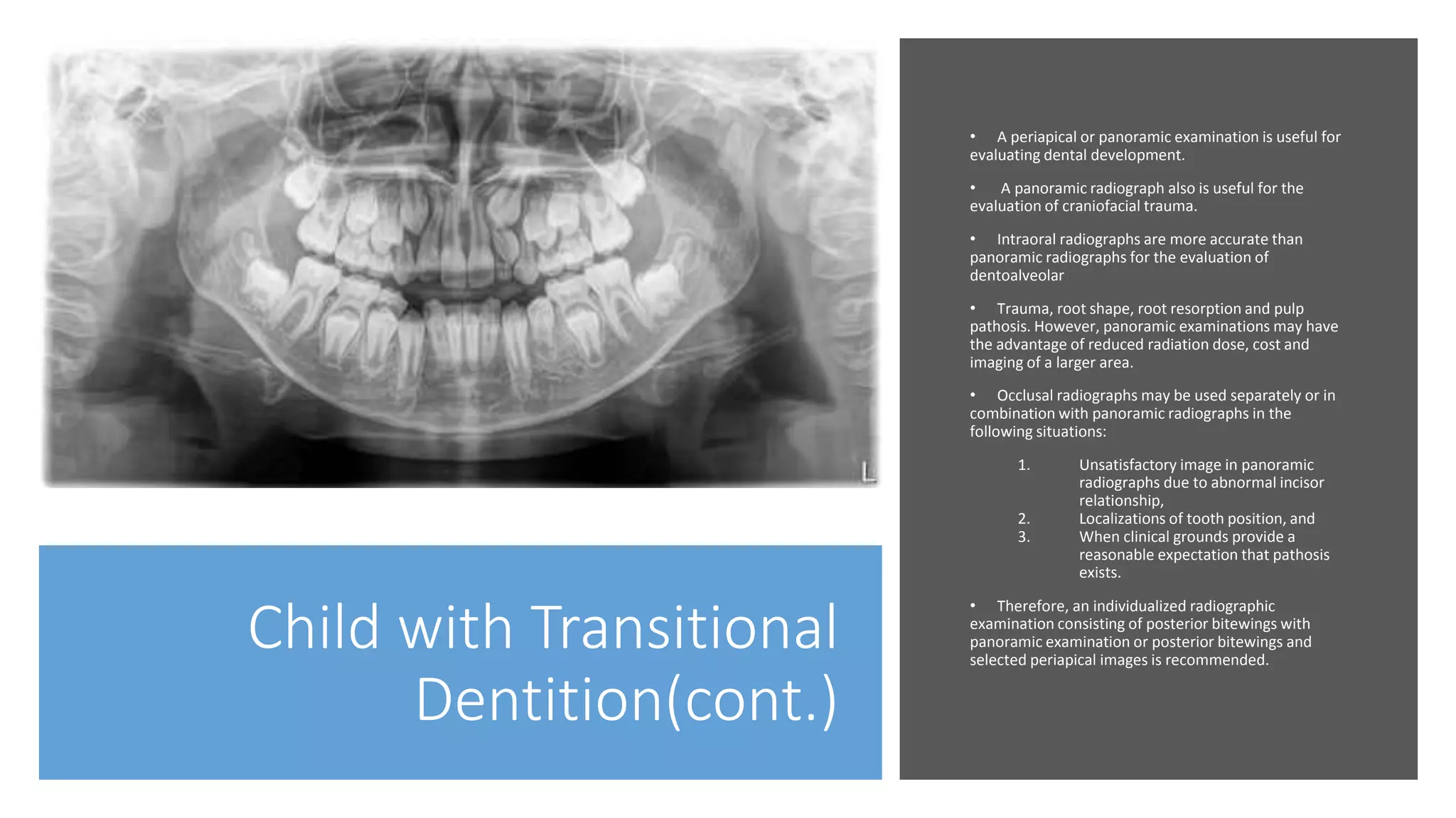 Guidelines for dental radiographs for pediatric and adolescent | PPTX