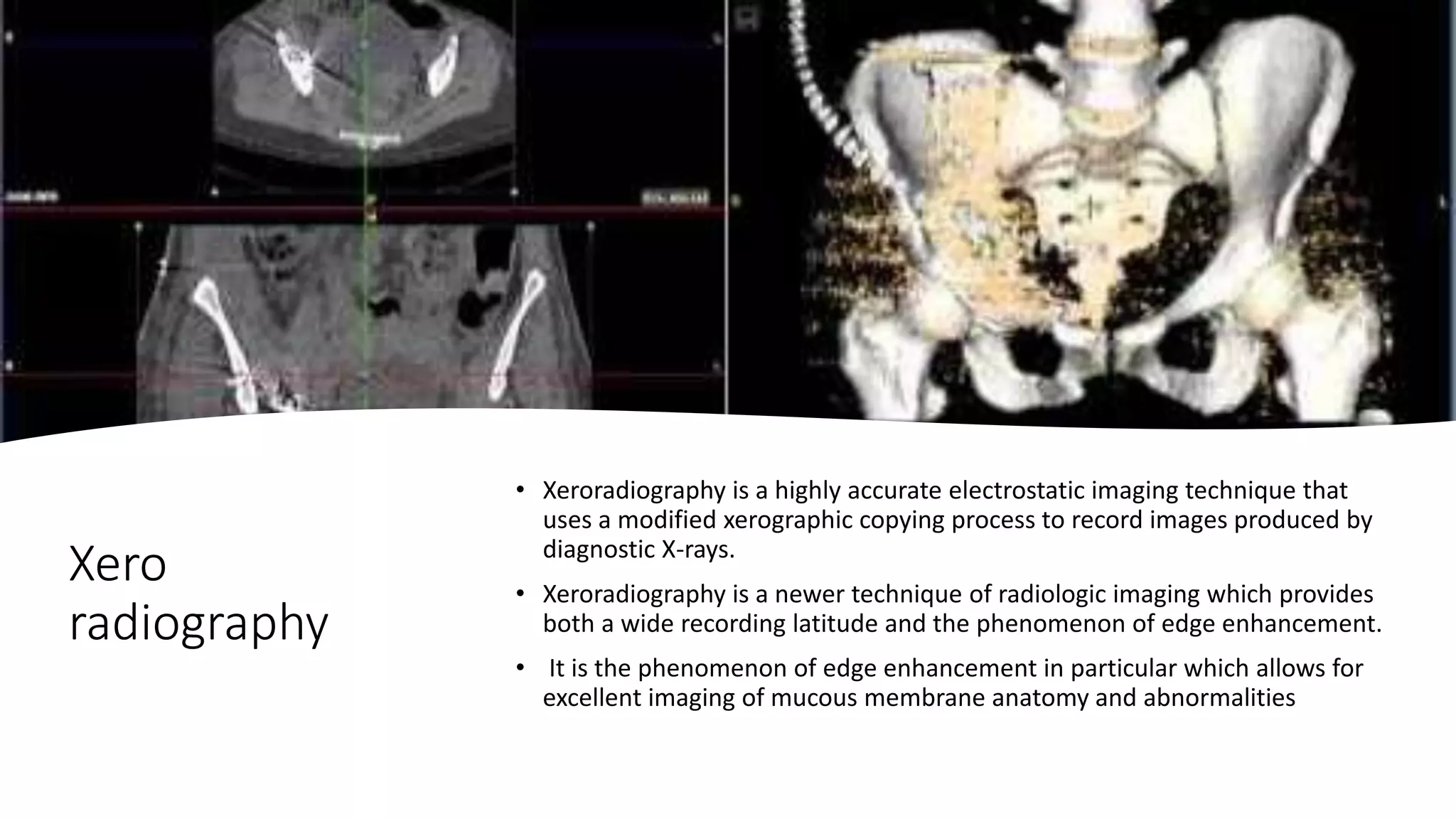 Guidelines for dental radiographs for pediatric and adolescent | PPTX
