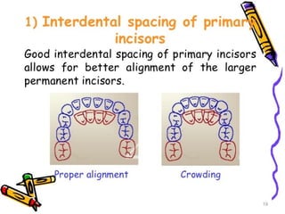 clinical features of mixed dentition period | PPT