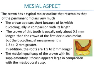 DENTAL ANATOMY OF PRIMARY MAXILLARY AND MANDIBULAR 2ND MOLAR . | PDF