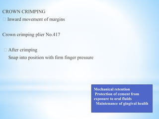 stainless steel crown | PPTX