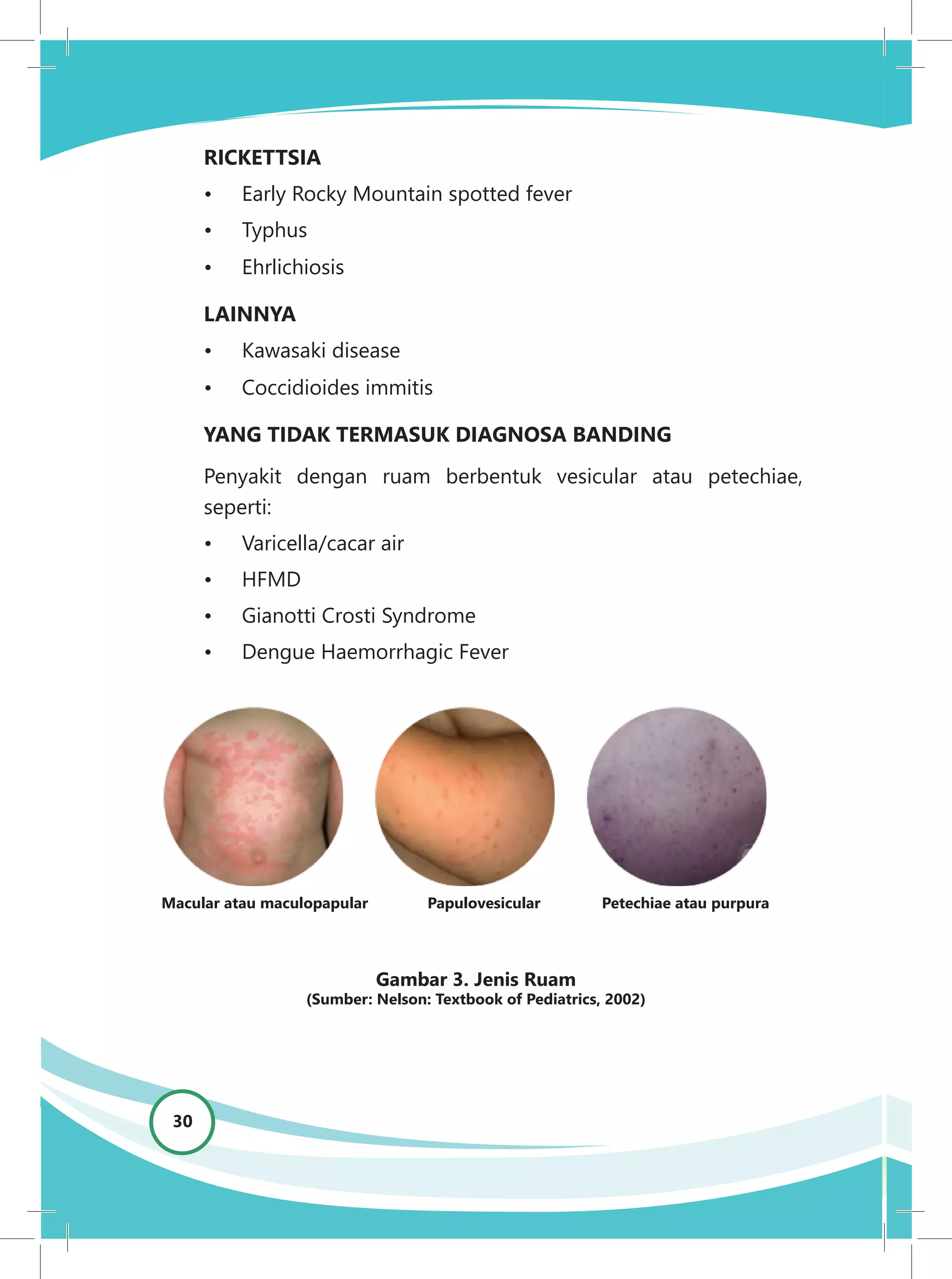 Pedoman_Campak_Rubella_2020.pdf