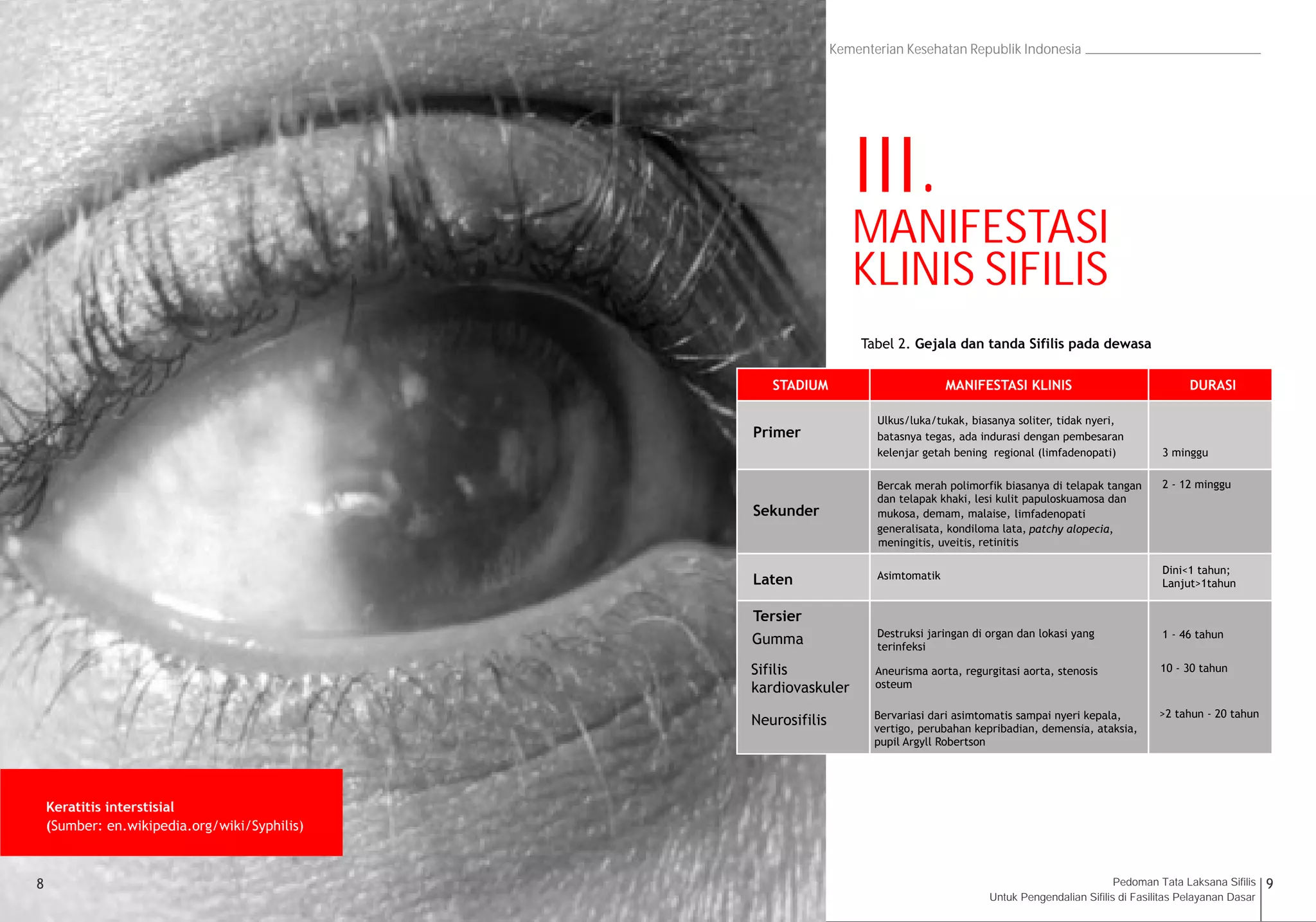 PEDOMAN_TATALAKSANA_SIFILIS_PUSKESMAS___merah_ok-1.pdf