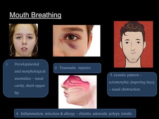 Aetiology of oral habits | PPTX