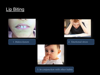 Aetiology of oral habits | PPTX