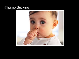 Aetiology of oral habits | PPTX