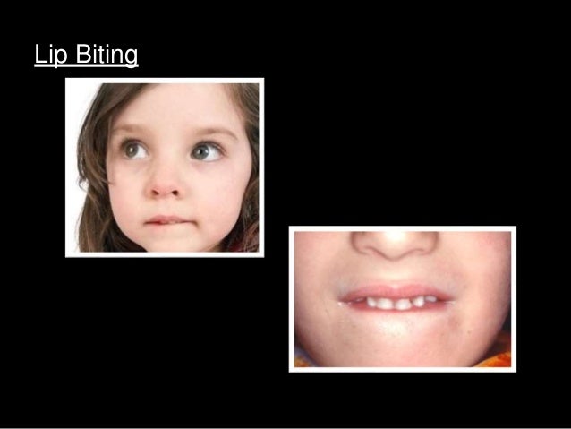 Aetiology of oral habits