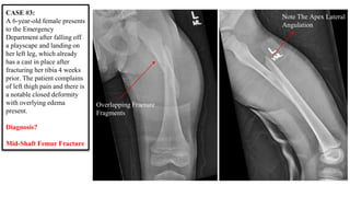 Dr. Kelsey Lena’s CMC Pediatric Orthopedic X-Ray Mastery Project ...