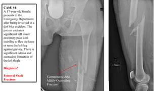 Dr. Kelsey Lena’s CMC Pediatric Orthopedic X-Ray Mastery Project ...