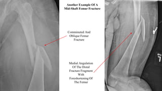 Dr. Kelsey Lena’s CMC Pediatric Orthopedic X-Ray Mastery Project ...