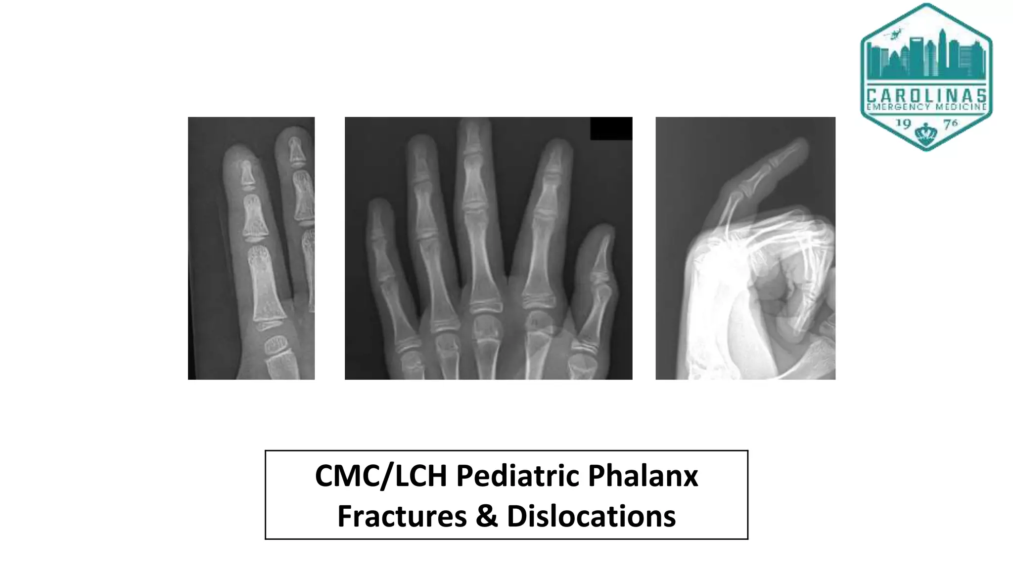Dr. Haley Dusek’s CMC Pediatric Orthopedic X-Ray Mastery Project: #6 ...