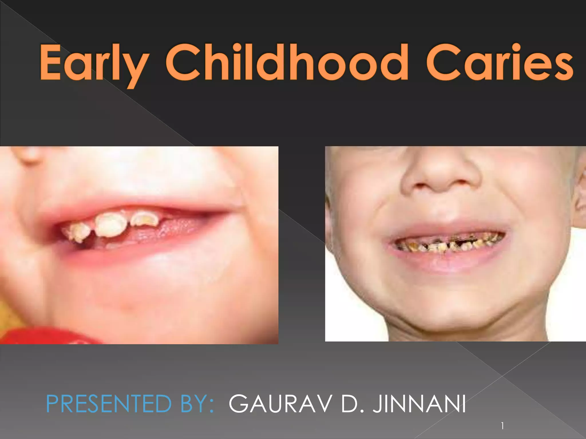 Early Childhood Caries Ppt Early Childhood Caries Pediatric