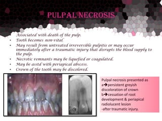 Diagnosis Of Pulpal Pathology In Pedodontics | PPTX