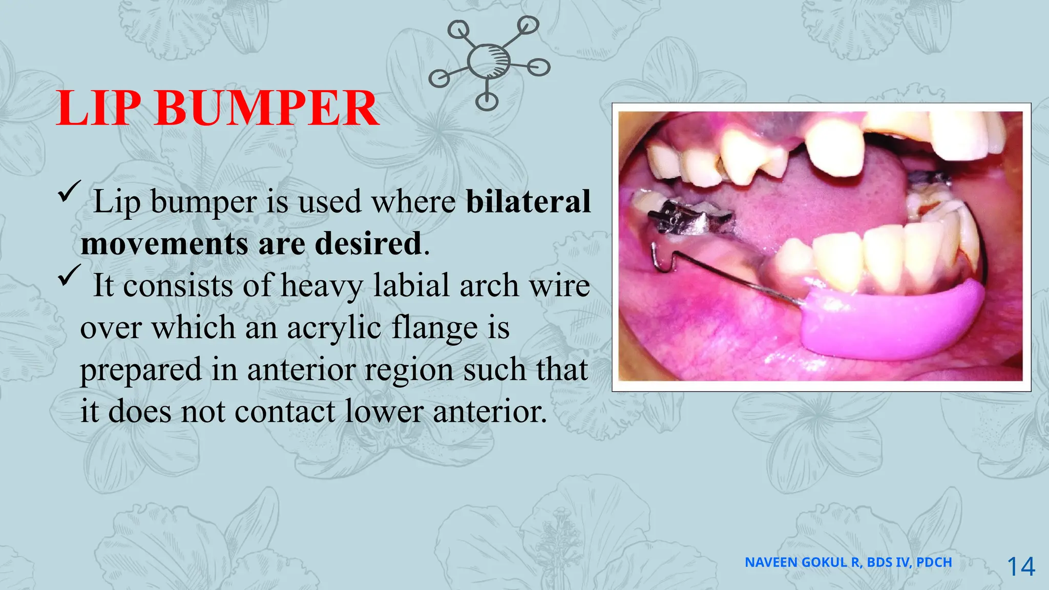 SPACE REGAINERS IN TOOTH LOSS (PEDIATRIC DENTISTRY) | PPTX