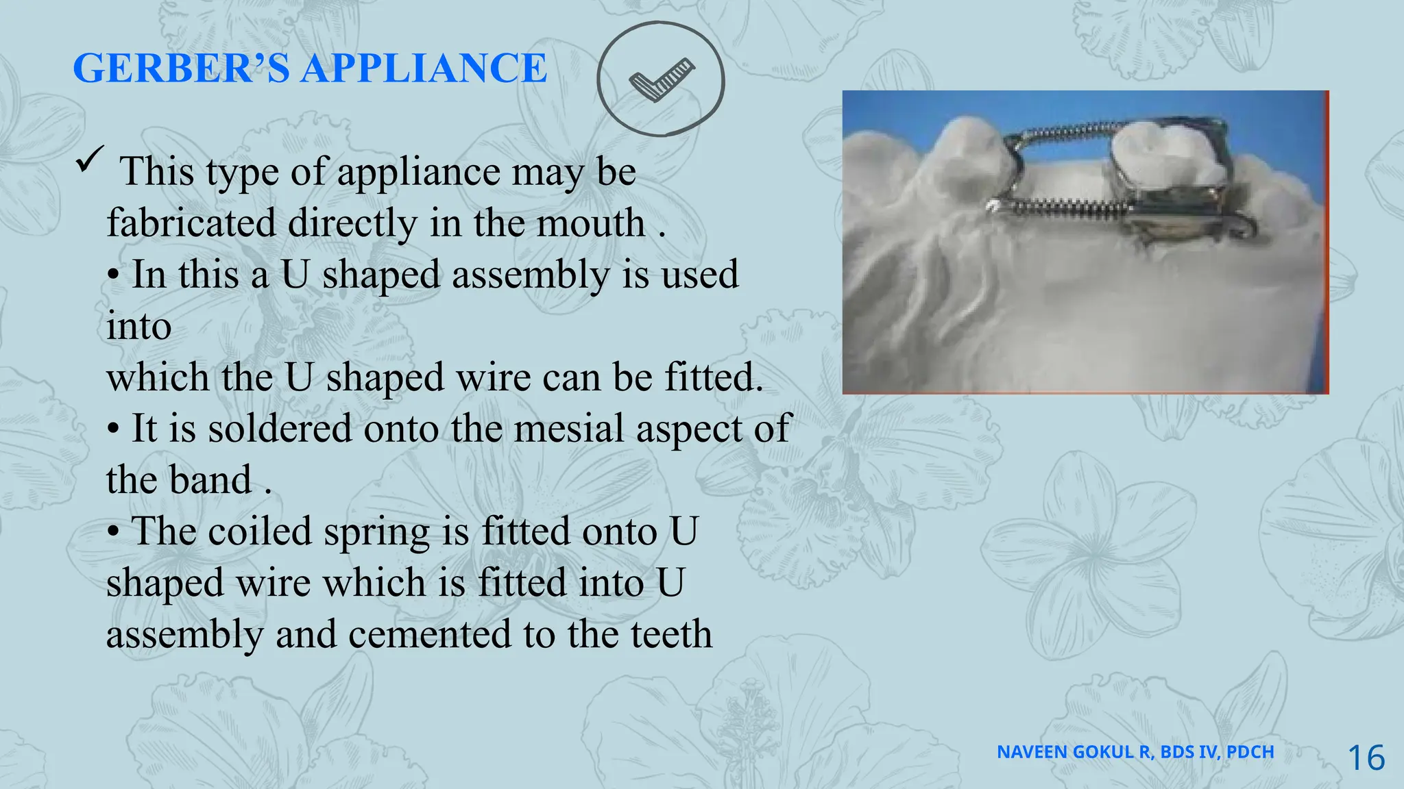 SPACE REGAINERS IN TOOTH LOSS (PEDIATRIC DENTISTRY) | PPTX