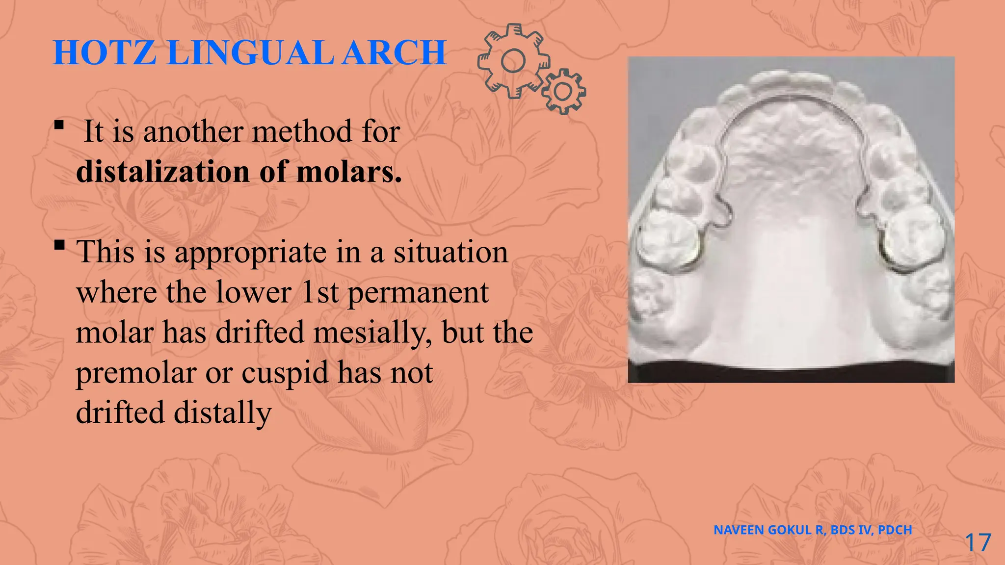 SPACE REGAINERS IN TOOTH LOSS (PEDIATRIC DENTISTRY) | PPTX