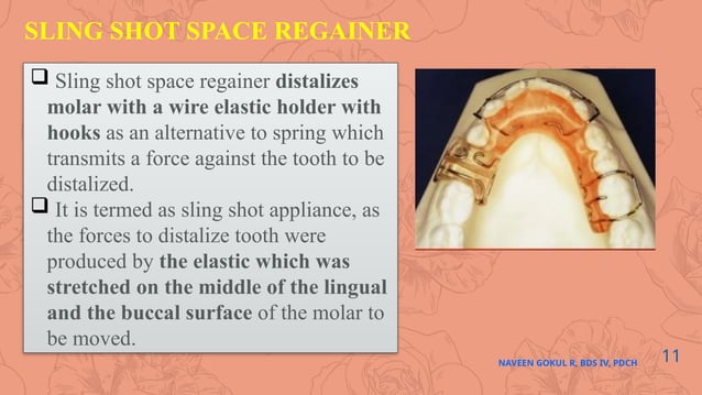 SPACE REGAINERS IN TOOTH LOSS (PEDIATRIC DENTISTRY) | PPTX | Dental ...