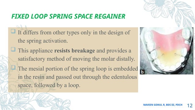 SPACE REGAINERS IN TOOTH LOSS (PEDIATRIC DENTISTRY) | PPTX | Dental ...