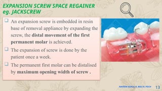 SPACE REGAINERS IN TOOTH LOSS (PEDIATRIC DENTISTRY) | PPTX