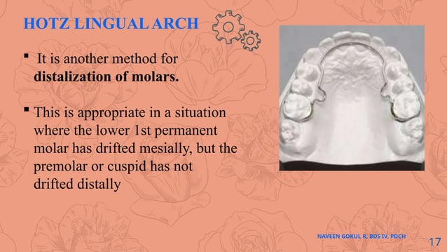 SPACE REGAINERS IN TOOTH LOSS (PEDIATRIC DENTISTRY) | PPTX | Dental ...