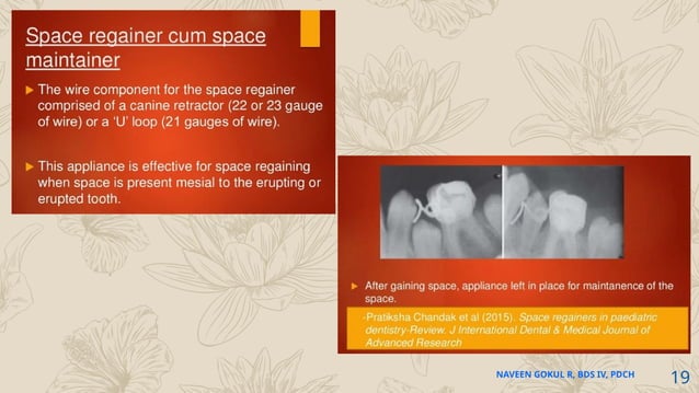 SPACE REGAINERS IN TOOTH LOSS (PEDIATRIC DENTISTRY) | PPTX | Dental ...
