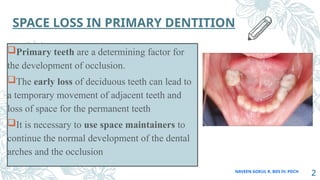 SPACE REGAINERS IN TOOTH LOSS (PEDIATRIC DENTISTRY) | PPTX