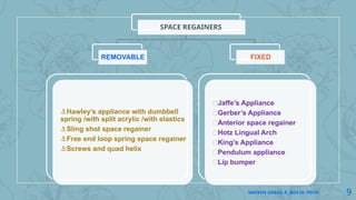 SPACE REGAINERS IN TOOTH LOSS (PEDIATRIC DENTISTRY) | PPTX