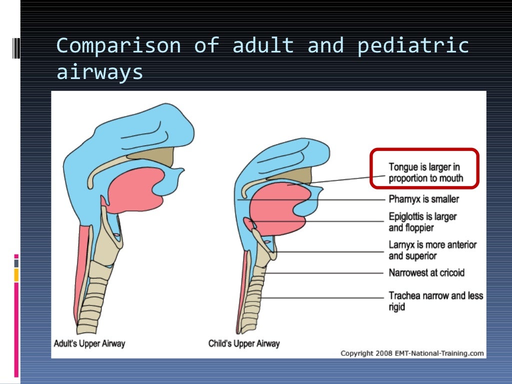Pediatric respiratory emergency : upper