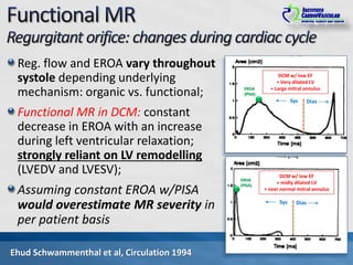 How to evaluate Functional MR. Why differences US vs EU? | PPT