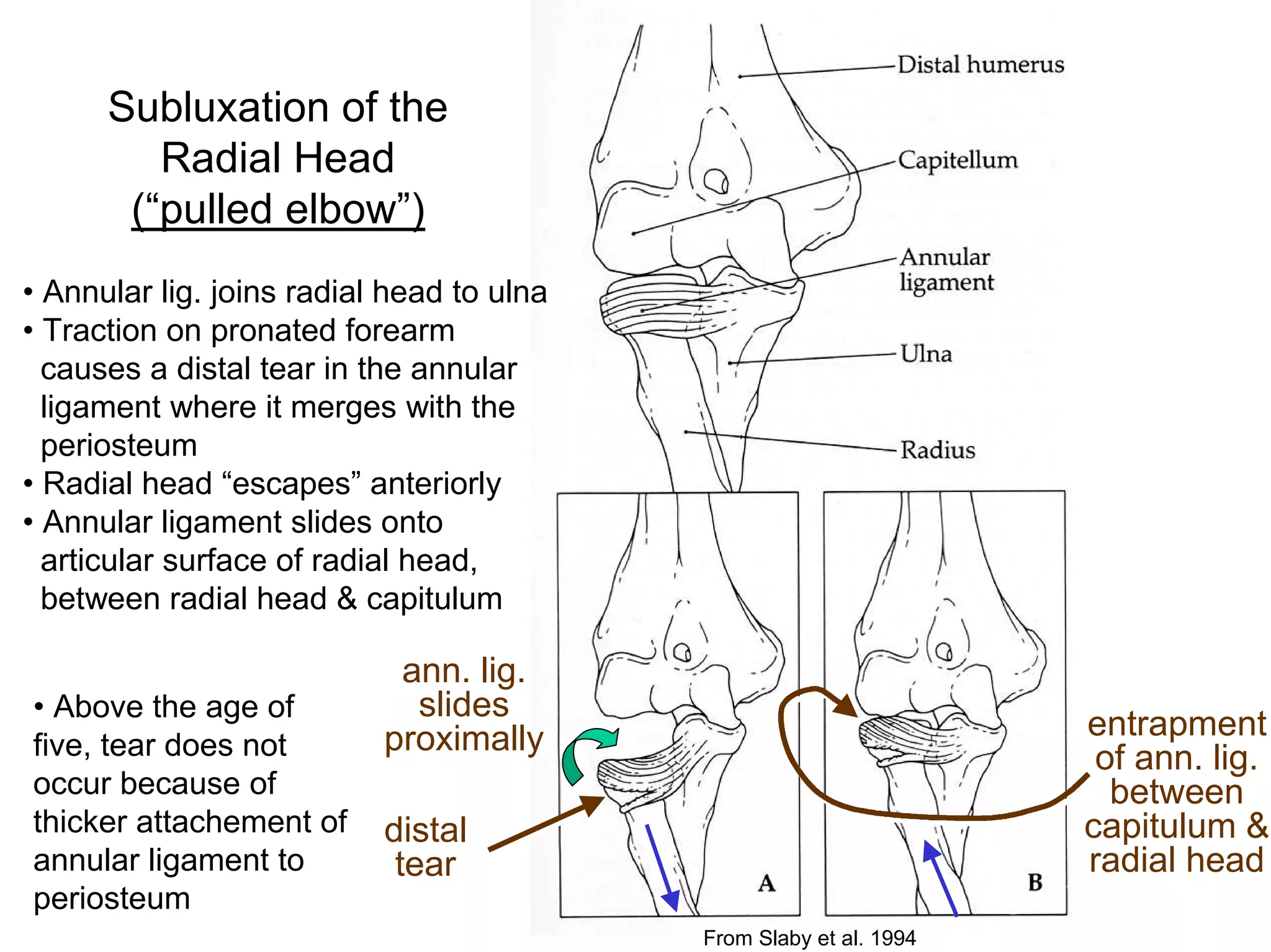 Peds ortho-anatomy | PDF
