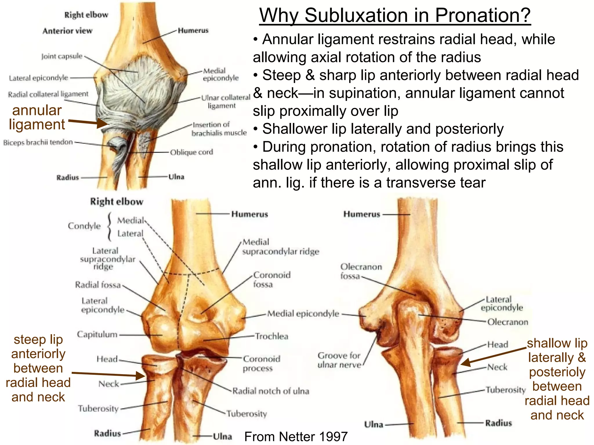 Peds ortho-anatomy | PDF