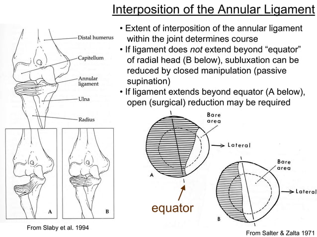 Peds ortho-anatomy | PDF